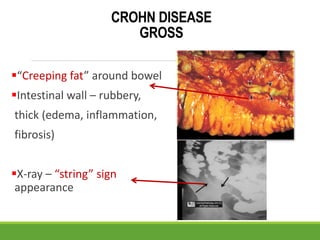 64-GIT 6.pdf peptic ulcer ND GASTRIC ULCer | PDF