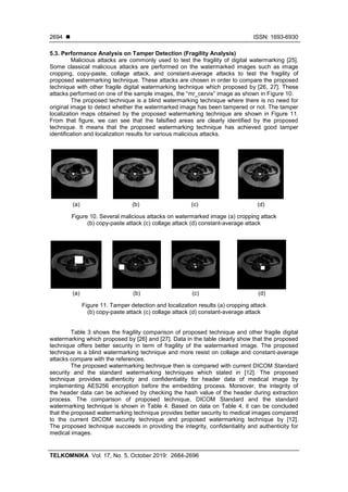 Advanced watermarking technique to improve medical images’ security | PDF