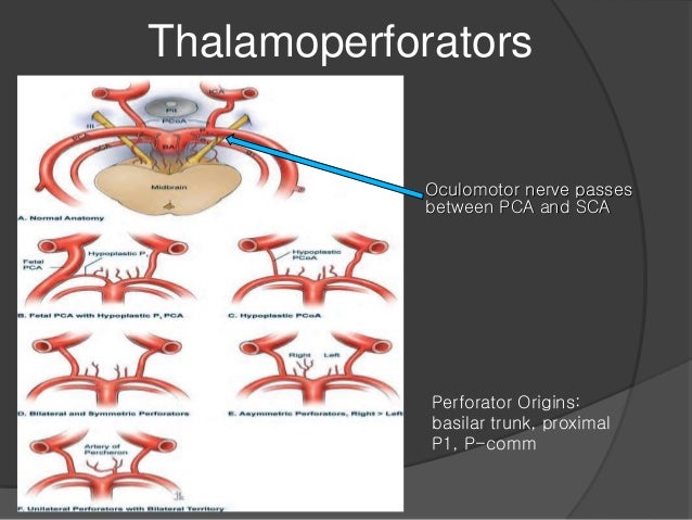 Basilar approaches Azam Basheer MD 9-2-14
