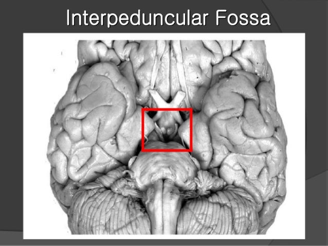 Basilar approaches Azam Basheer MD 9-2-14