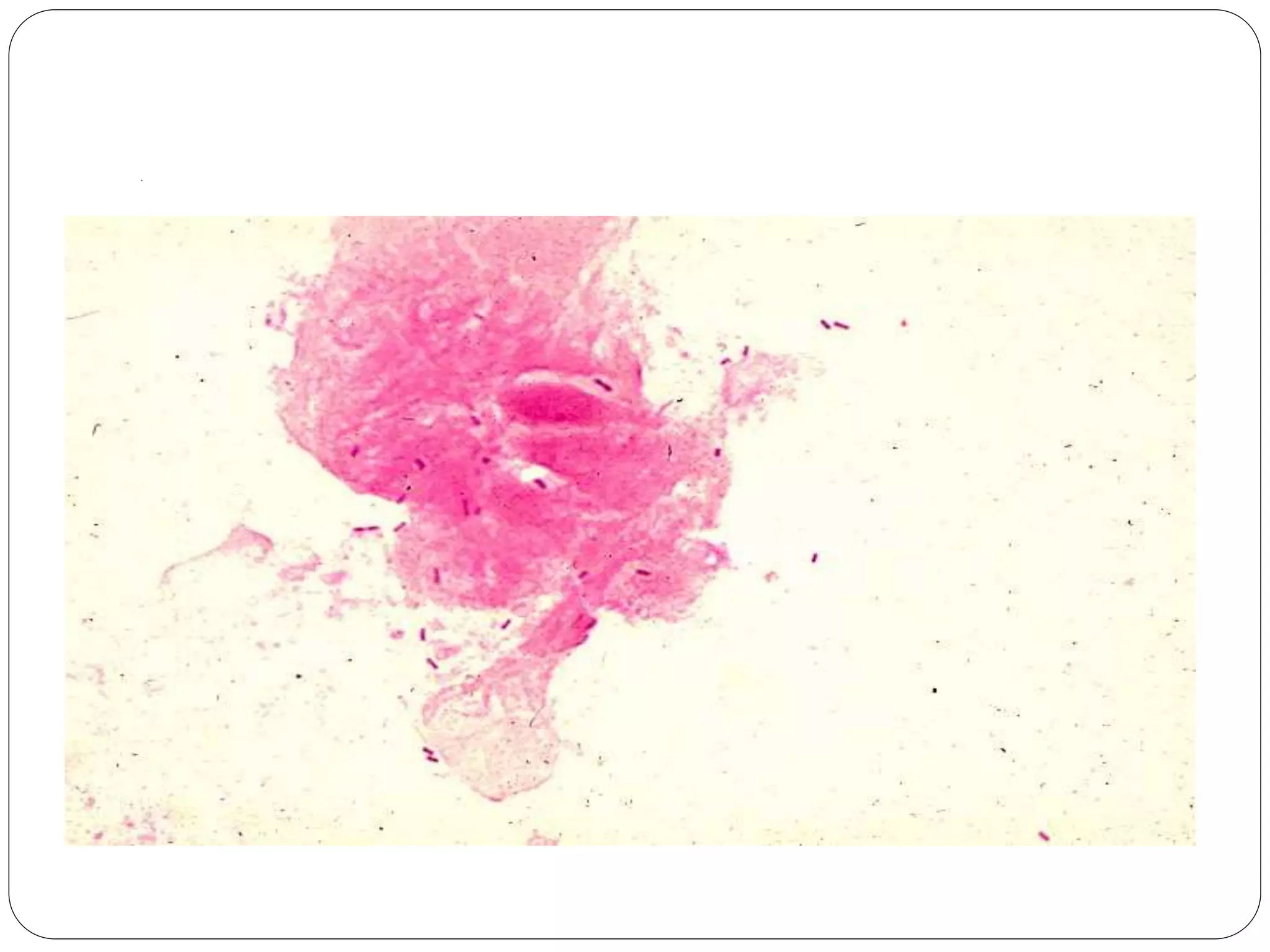 DIRECT MICROSCOPY PPT 1 | PPT