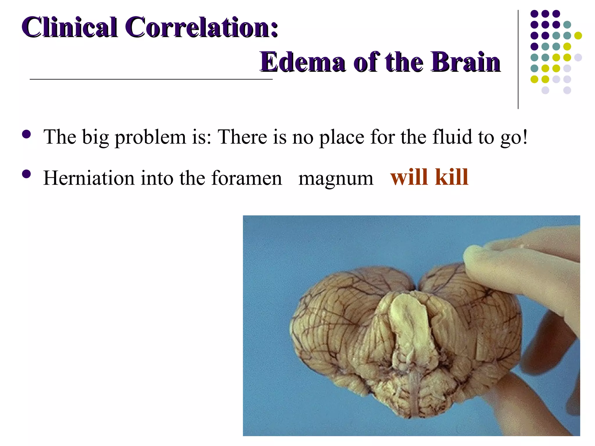 64965 hemodyn[1] edema | PPT
