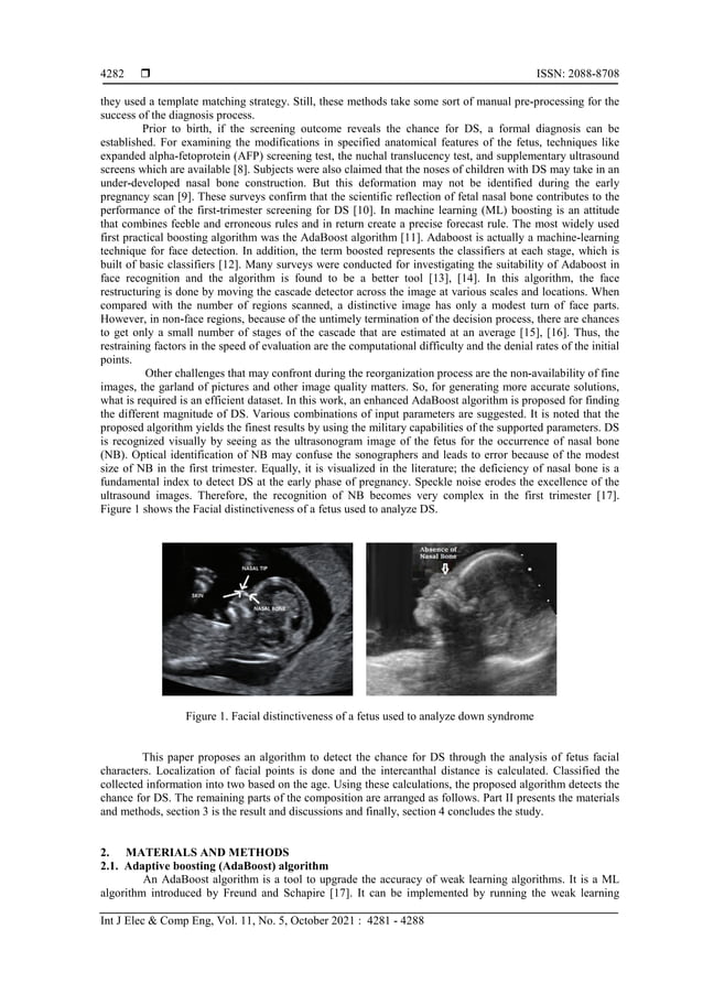 Down syndrome detection using modified adaboost algorithm | PDF | Genetics | Science