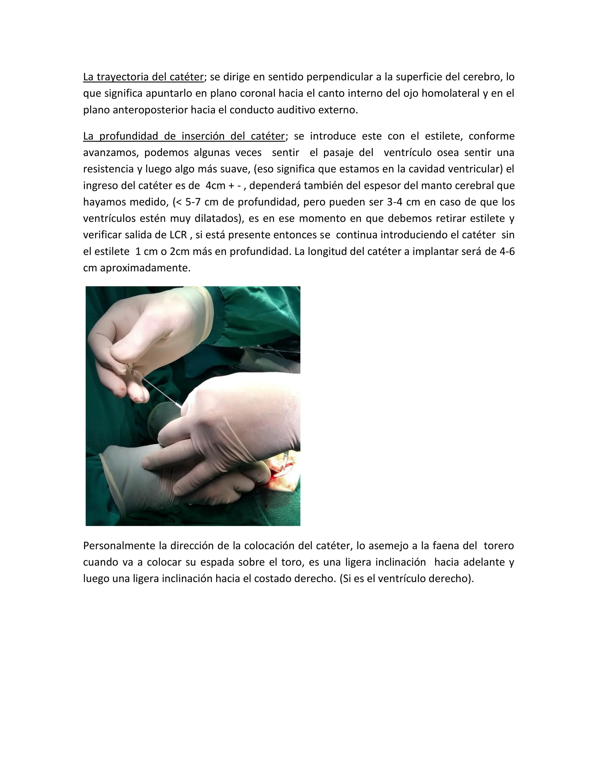 Técnica de colocación del sistema de derivación ventriculo peritoneal | PDF
