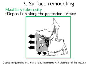 Growth of maxilla | PPTX