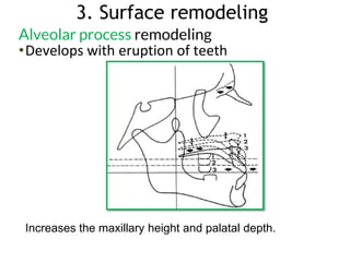 Growth of maxilla | PPTX
