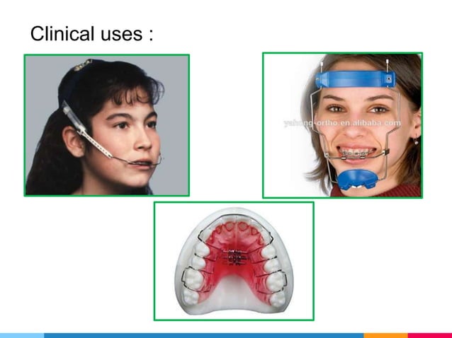 Growth of maxilla | PPTX