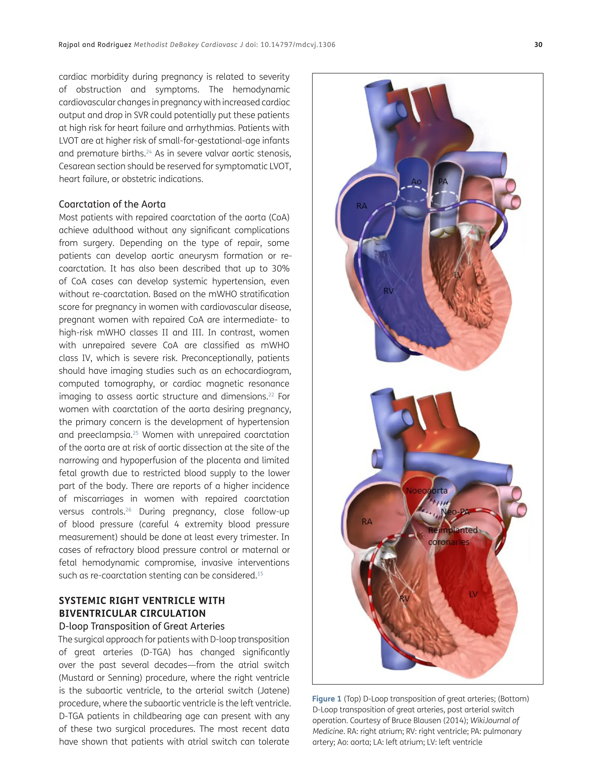 High risk congenital heart disease in pregnancy.pdf