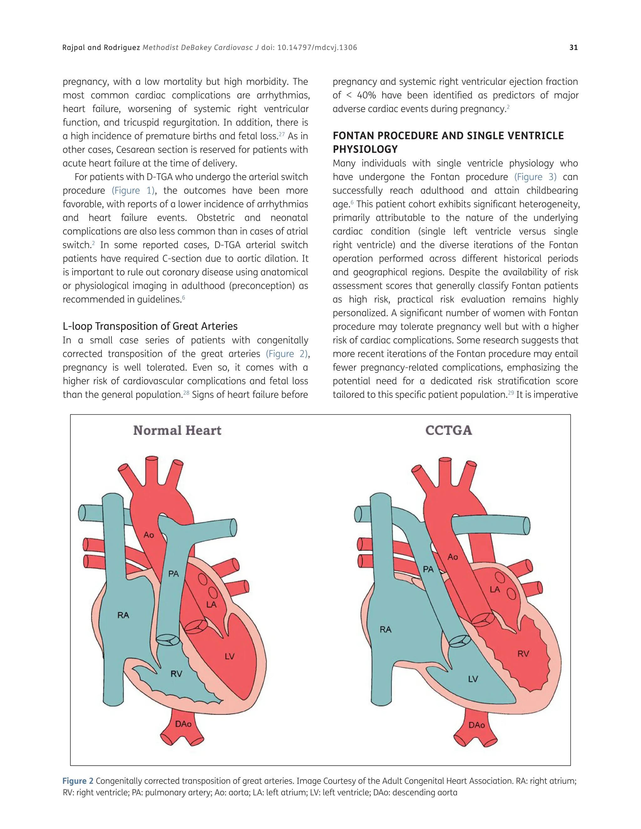 High risk congenital heart disease in pregnancy.pdf