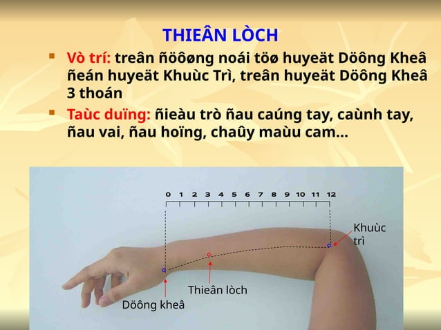 65 huyet thuong dung.ppt65 huyet thuong dung.ppt65 huyet thuong dung.ppt