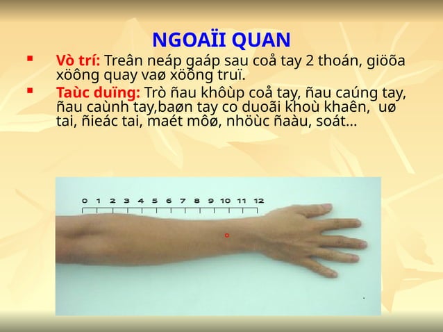 65 huyet thuong dung.ppt65 huyet thuong dung.ppt65 huyet thuong dung.ppt