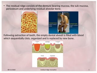 660365804-Residual-ridge-resorption-seminar-PART-2.pptx
