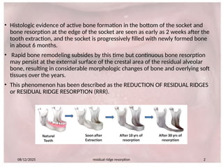 660365804-Residual-ridge-resorption-seminar-PART-2.pptx