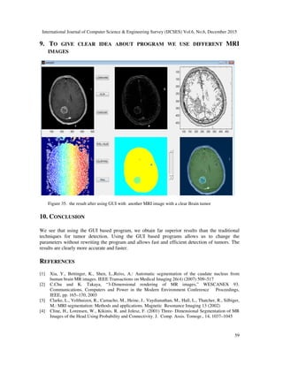 DETECTING BRAIN TUMOUR FROM MRI IMAGE USING MATLAB GUI PROGRAMME | PDF