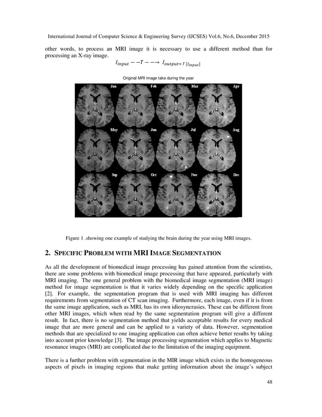 DETECTING BRAIN TUMOUR FROM MRI IMAGE USING MATLAB GUI PROGRAMME | PDF
