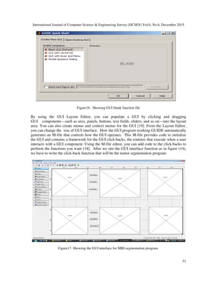 DETECTING BRAIN TUMOUR FROM MRI IMAGE USING MATLAB GUI PROGRAMME | PDF