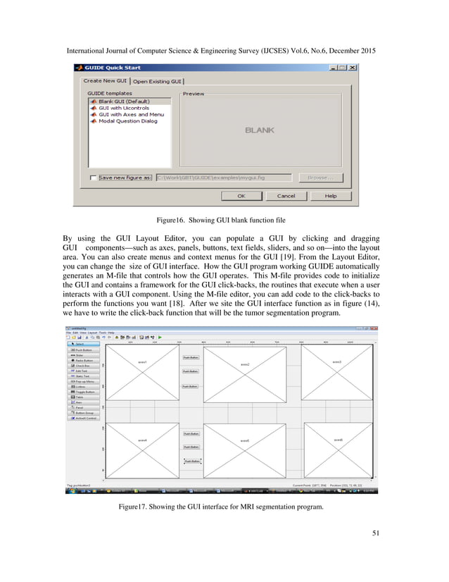 DETECTING BRAIN TUMOUR FROM MRI IMAGE USING MATLAB GUI PROGRAMME | PDF