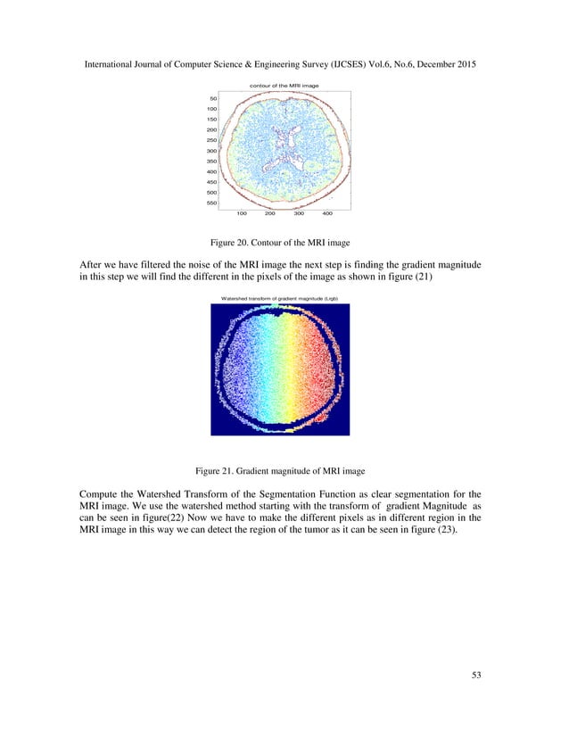 DETECTING BRAIN TUMOUR FROM MRI IMAGE USING MATLAB GUI PROGRAMME | PDF