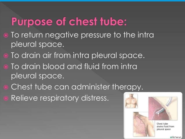 CHEST DRAINAGE.pptx