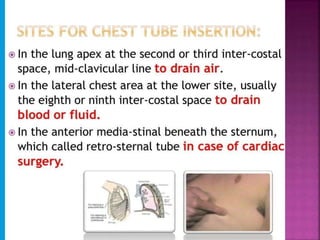 CHEST DRAINAGE.pptx