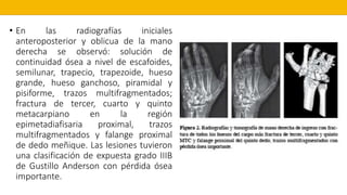 anatomia de la mano completa huesos, region palamar y dorlsal | PPTX