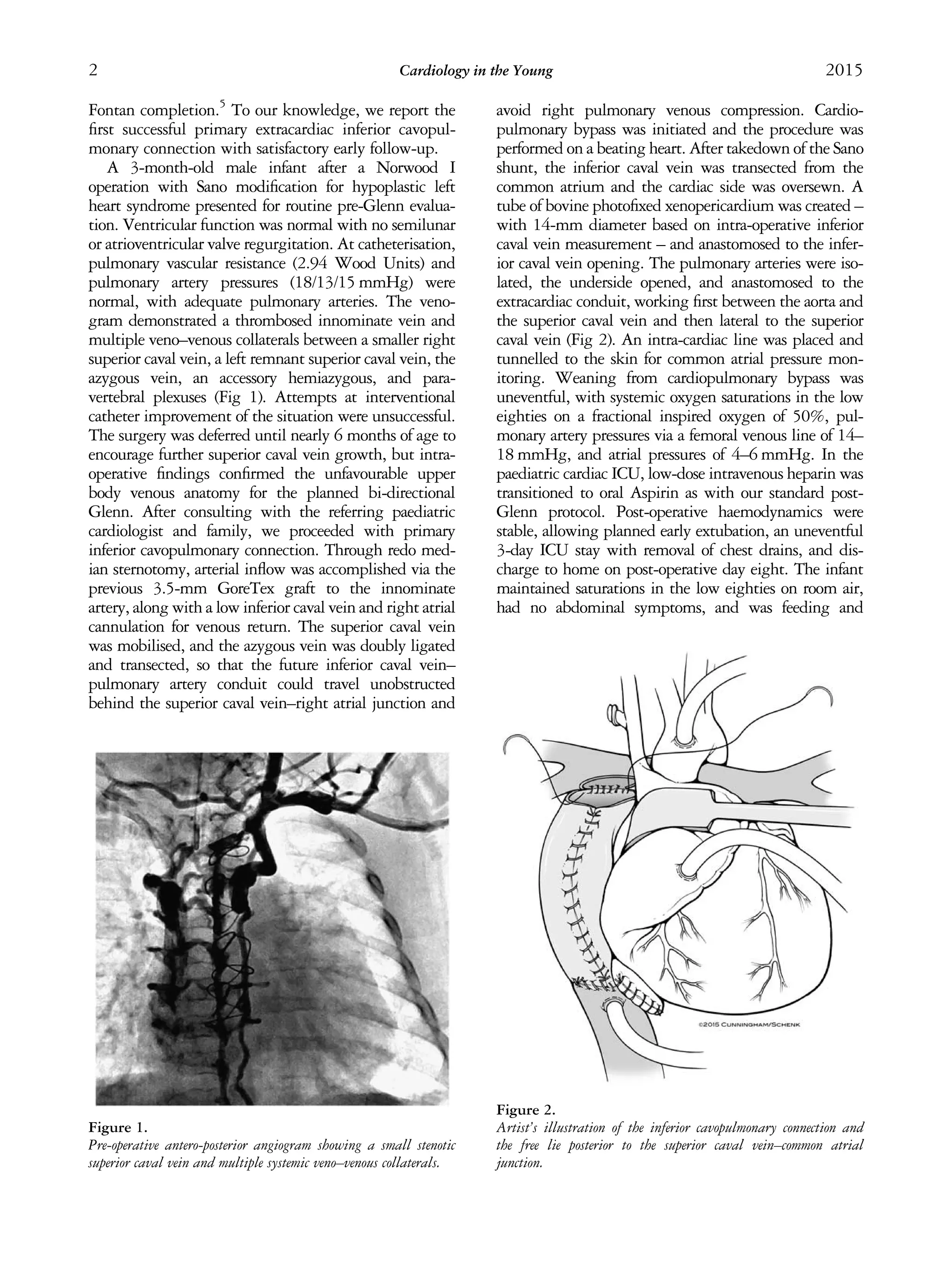 upside down Glenn CTY | PDF