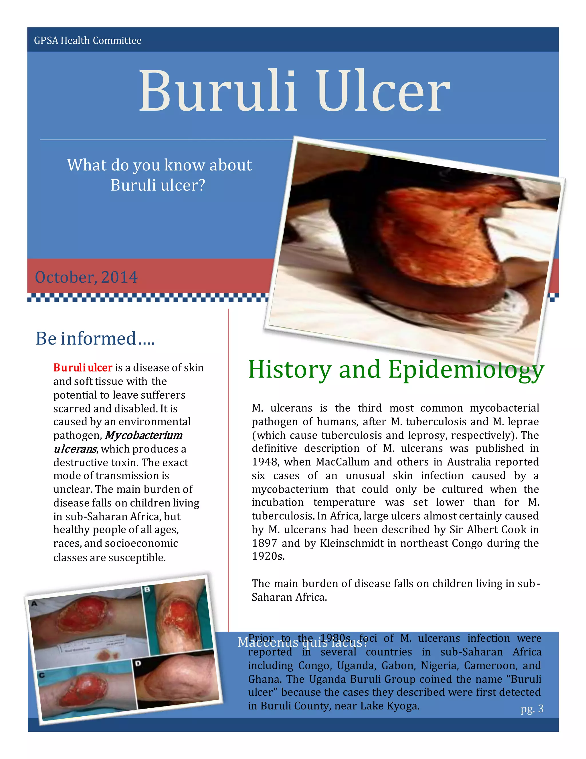 buruli ulcer | DOCX
