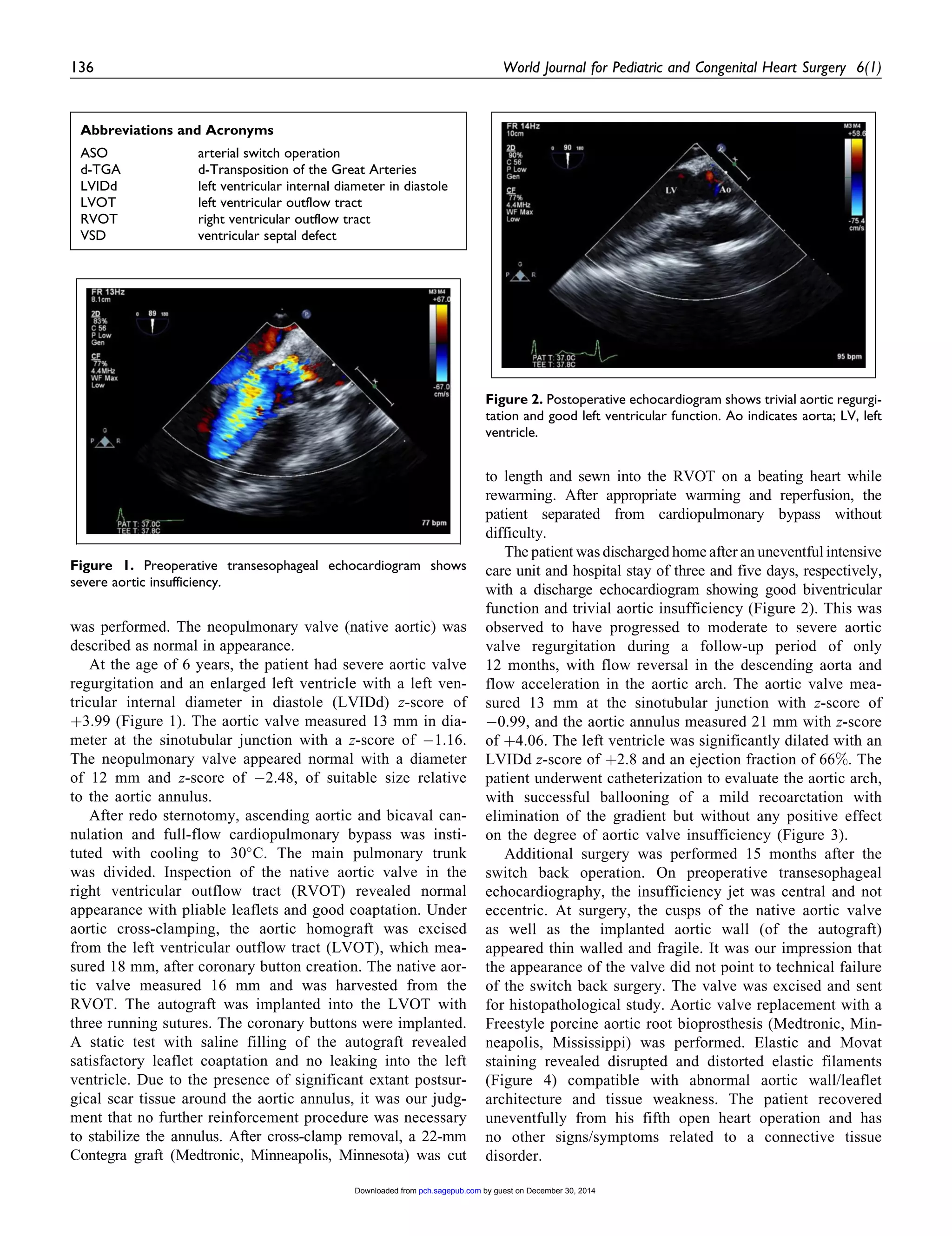 Switch back reverse Ross WJPCHS | PDF | Heart and Cardiovascular Diseases | Diseases and Conditions