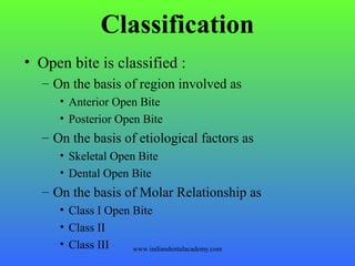 Management of open-bite in orthodontics | PPT