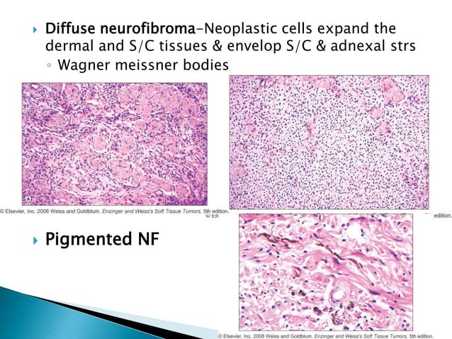 67. peripheral nerves | PPT