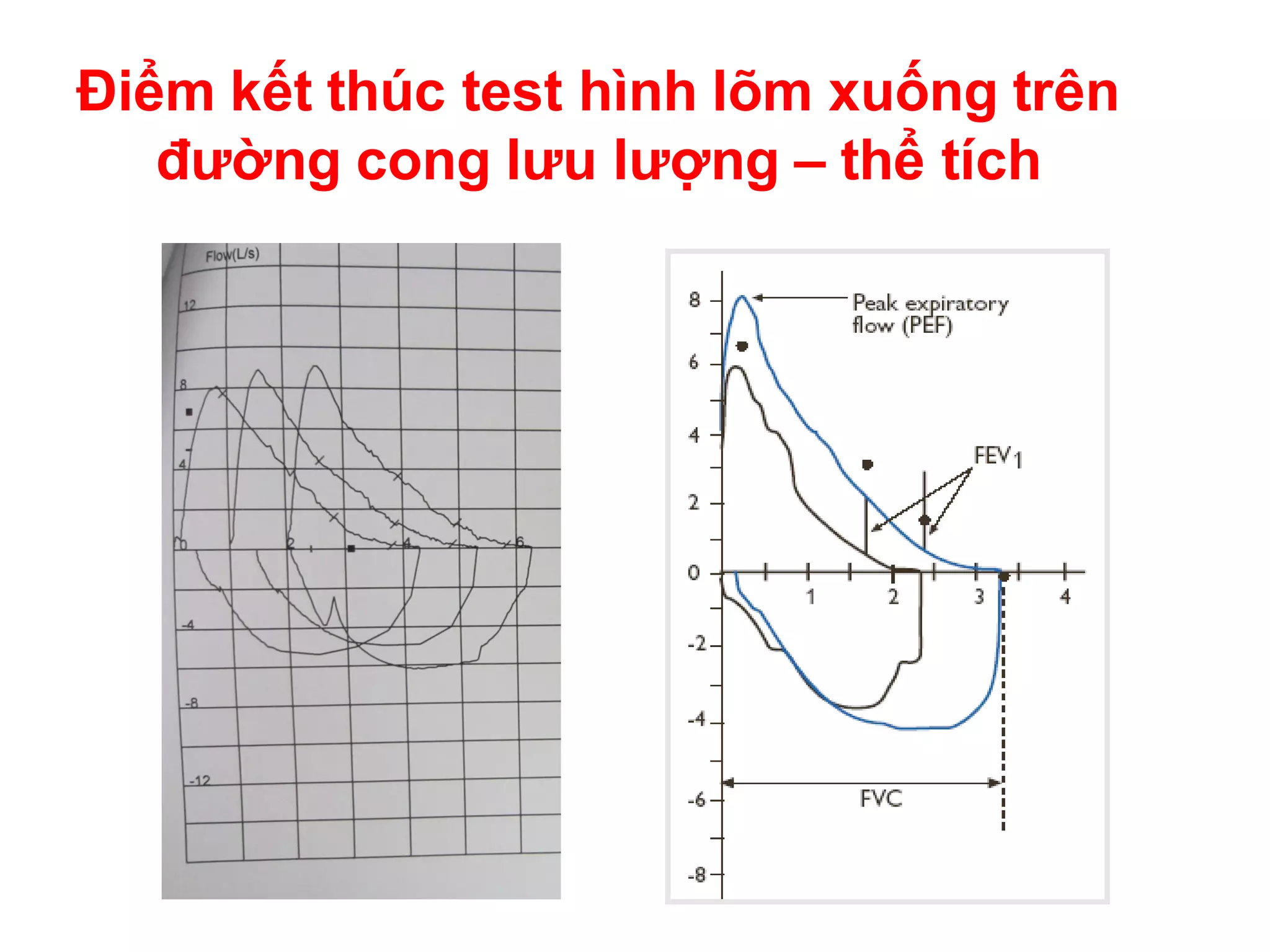 THỰC HÀNH ĐỌC KẾT QUẢ ĐO CHỨC NĂNG HÔ HẤP | PDF