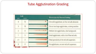 67. ABO isoagglutinintitration application, method and controversies.pdf