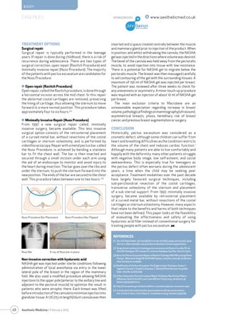 Dr Treacy’s CASEBOOK 'Treating pectus excavatum medically with ...
