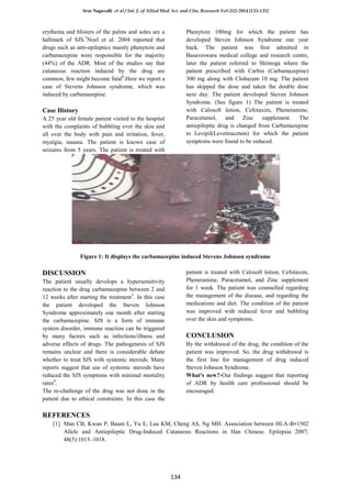 Carbamazepine induced Steven Johnson syndrome: A case report | PDF