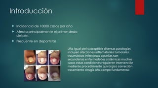 Técnica quirúrgica onicectomia complicaciones pptx | PPTX
