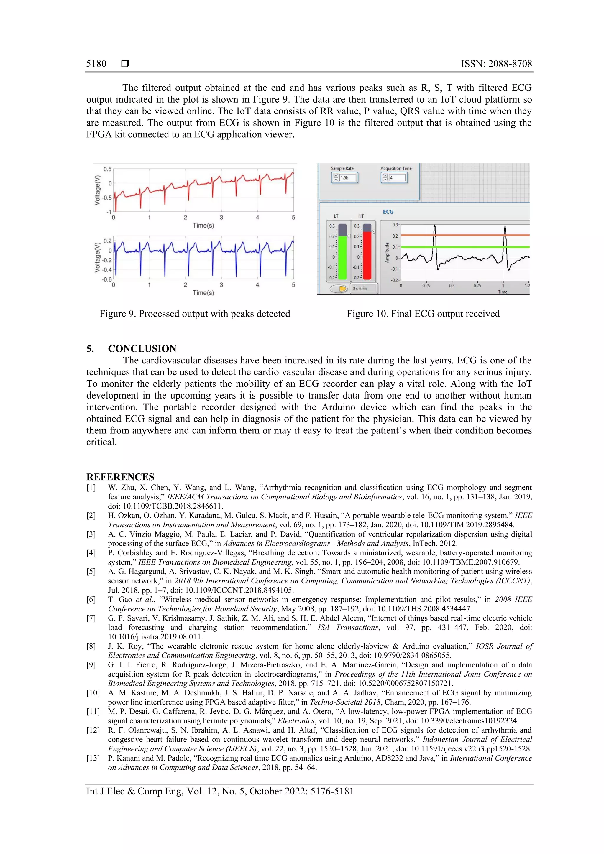 Design and implementation of portable electrocardiogram recorder with field programmable gate ...