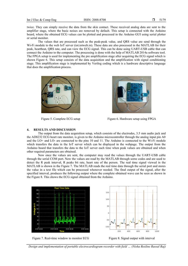 Design and implementation of portable electrocardiogram recorder with field programmable gate ...