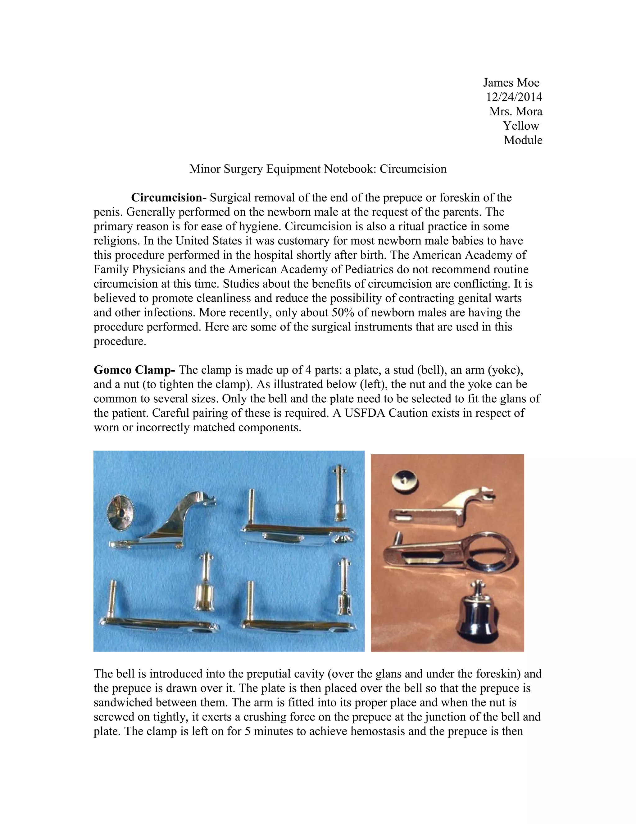 Electronic Notebook Circumcision Procedure Surgical Tools | DOC