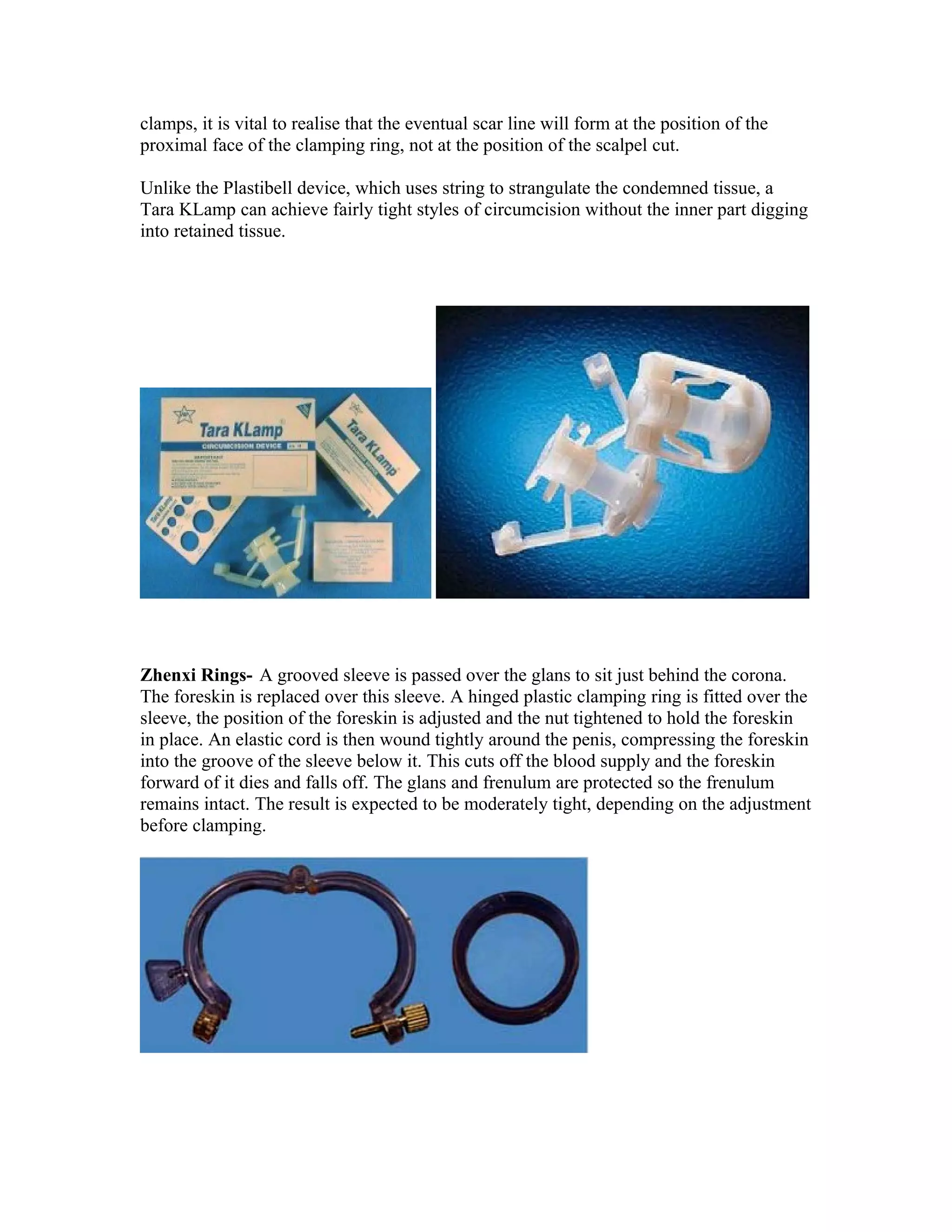 Electronic Notebook Circumcision Procedure Surgical Tools | DOC