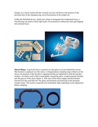 Electronic Notebook Circumcision Procedure Surgical Tools | DOC