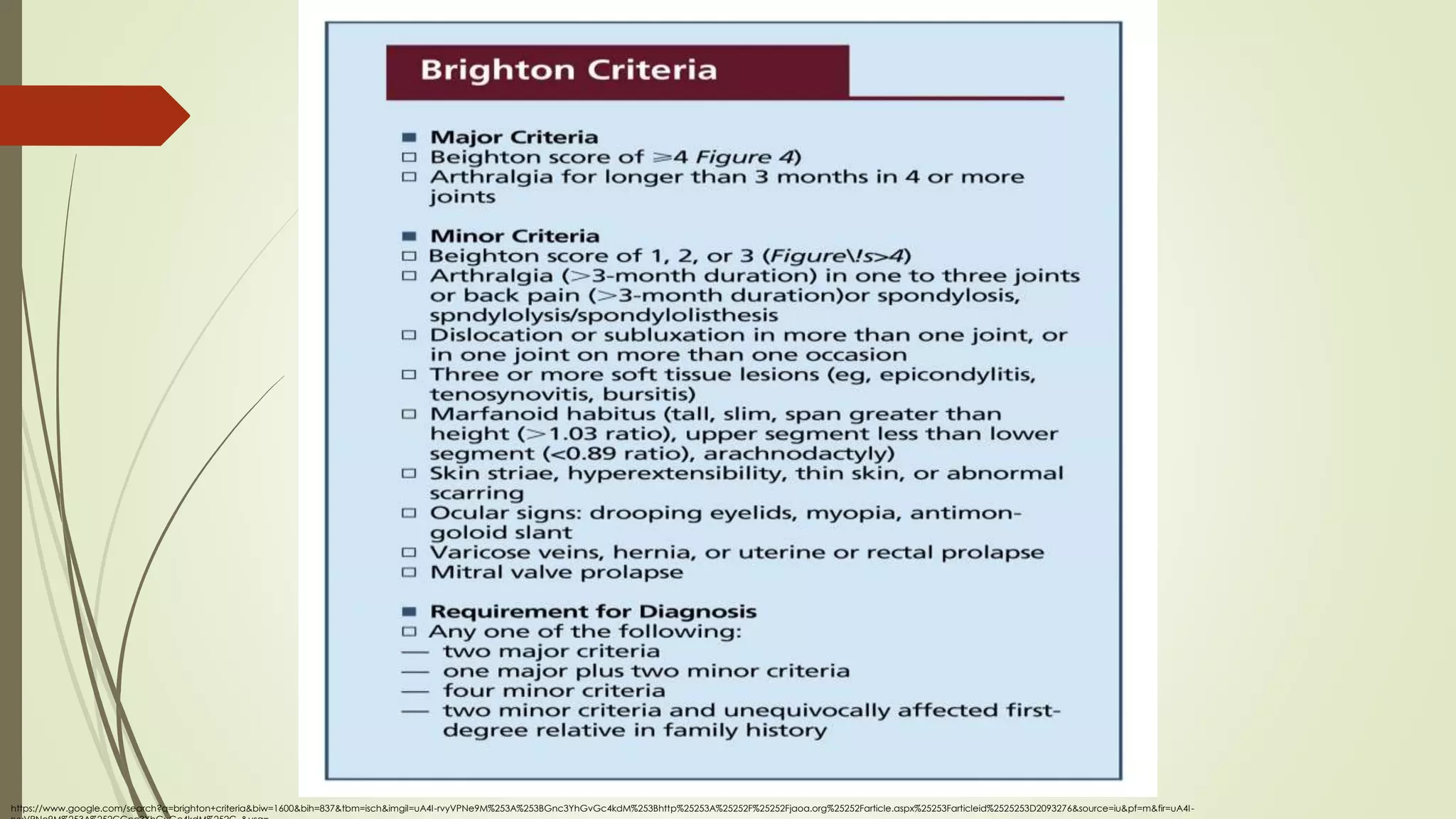 Ehlers-Danlos syndromes(EDS) | PPTX