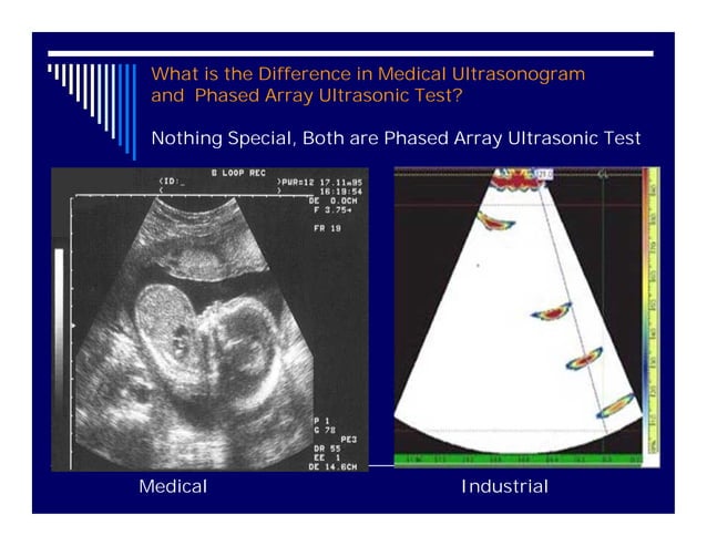 Presentation On Prospect Of Non Destructive Testing And Condition Monitoring Application In