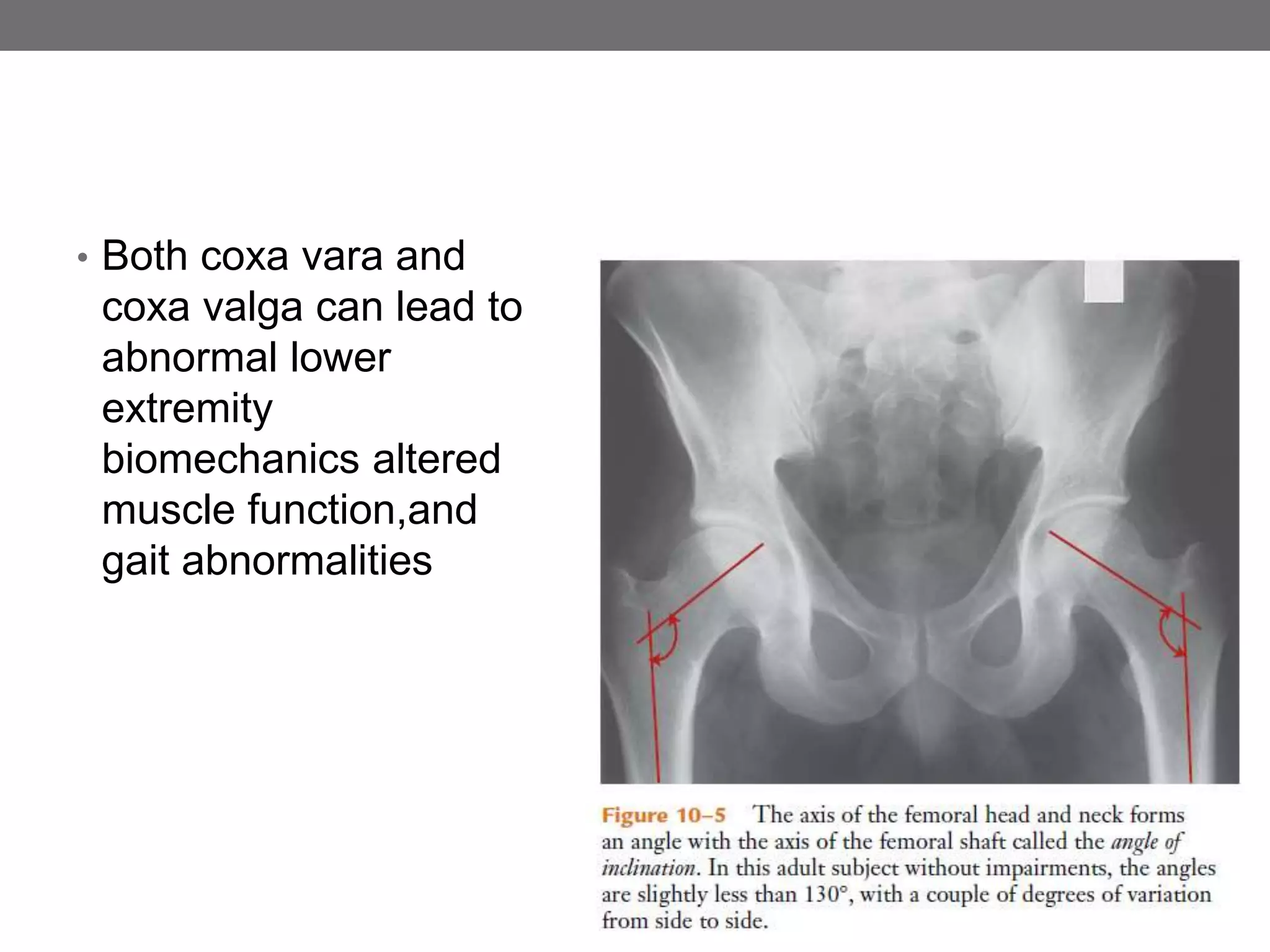 BIOMECHANICS OF HIP JOINT BY Dr. VIKRAM | PPTX