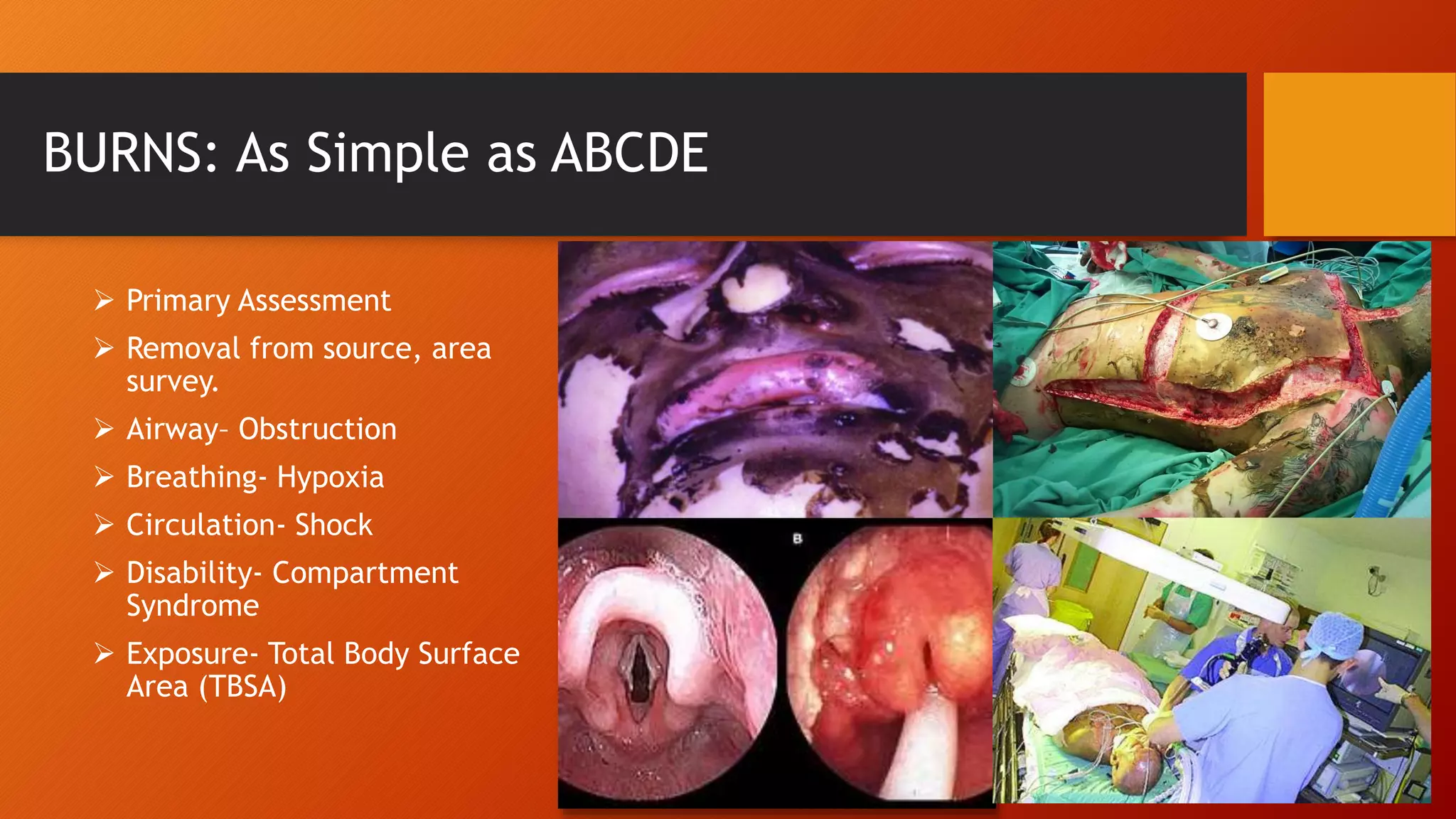 BURNS- Derm Presentation | PPTX