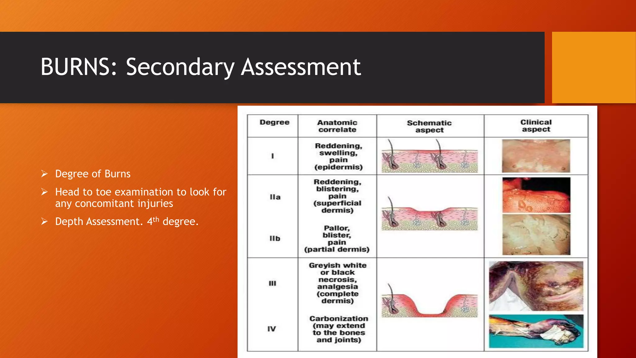 BURNS- Derm Presentation | PPTX