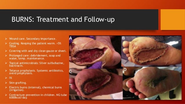 BURNS- Derm Presentation