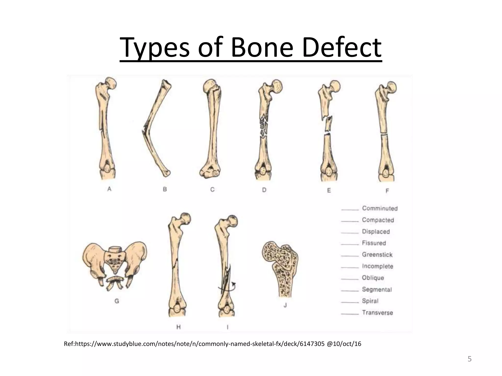 Literature Review " Design and FEA of Lattice Structure based ...
