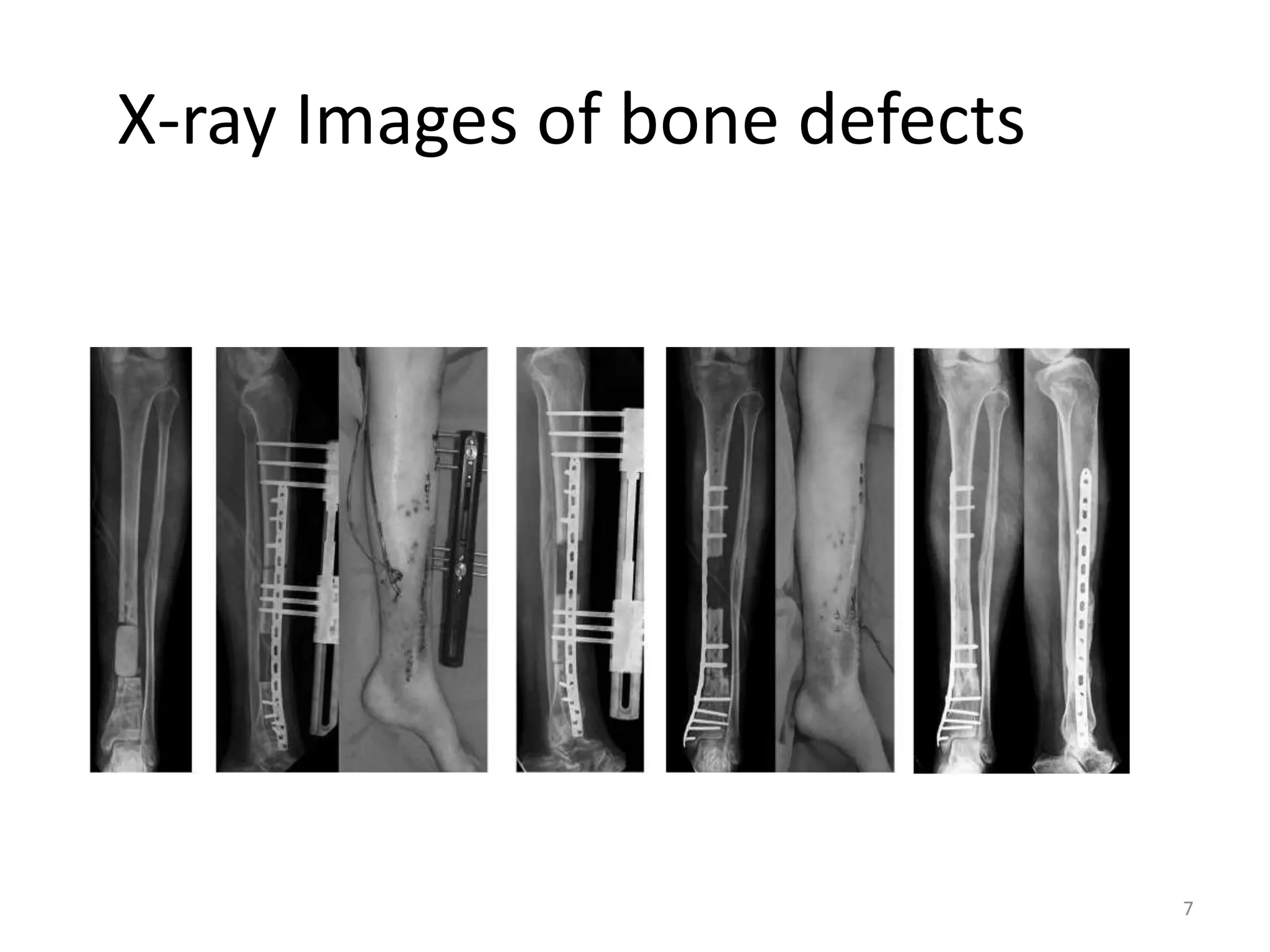 Literature Review " Design and FEA of Lattice Structure based ...