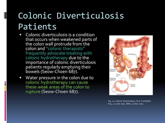 ColonicHydrotherapy | PPTX | Physical Therapy | Wellness