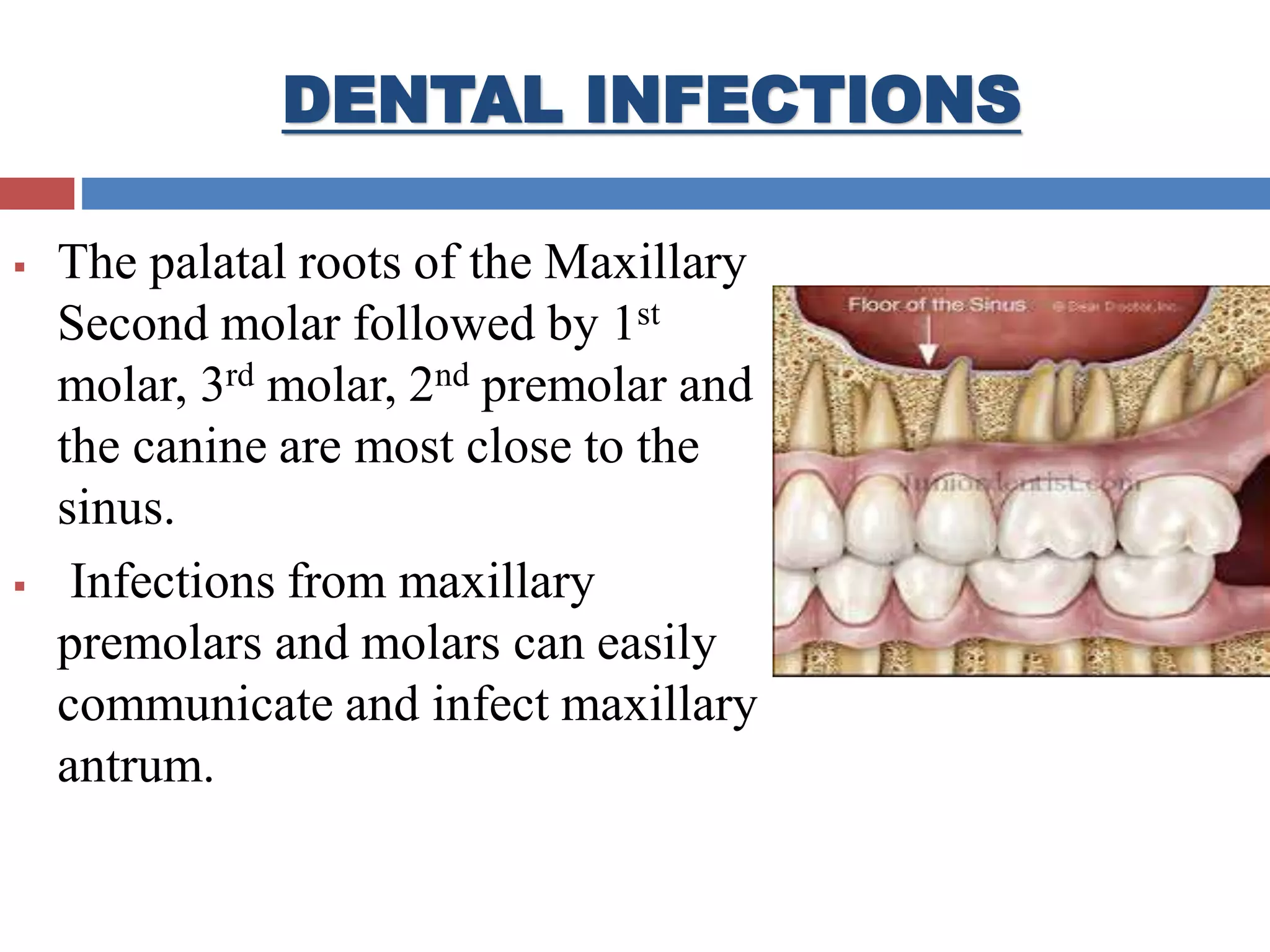 Maxillary Sinus. (Histology & Clinical Implications) | PDF